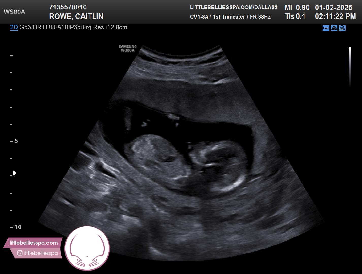 Caitlin Rowe | Super Mom